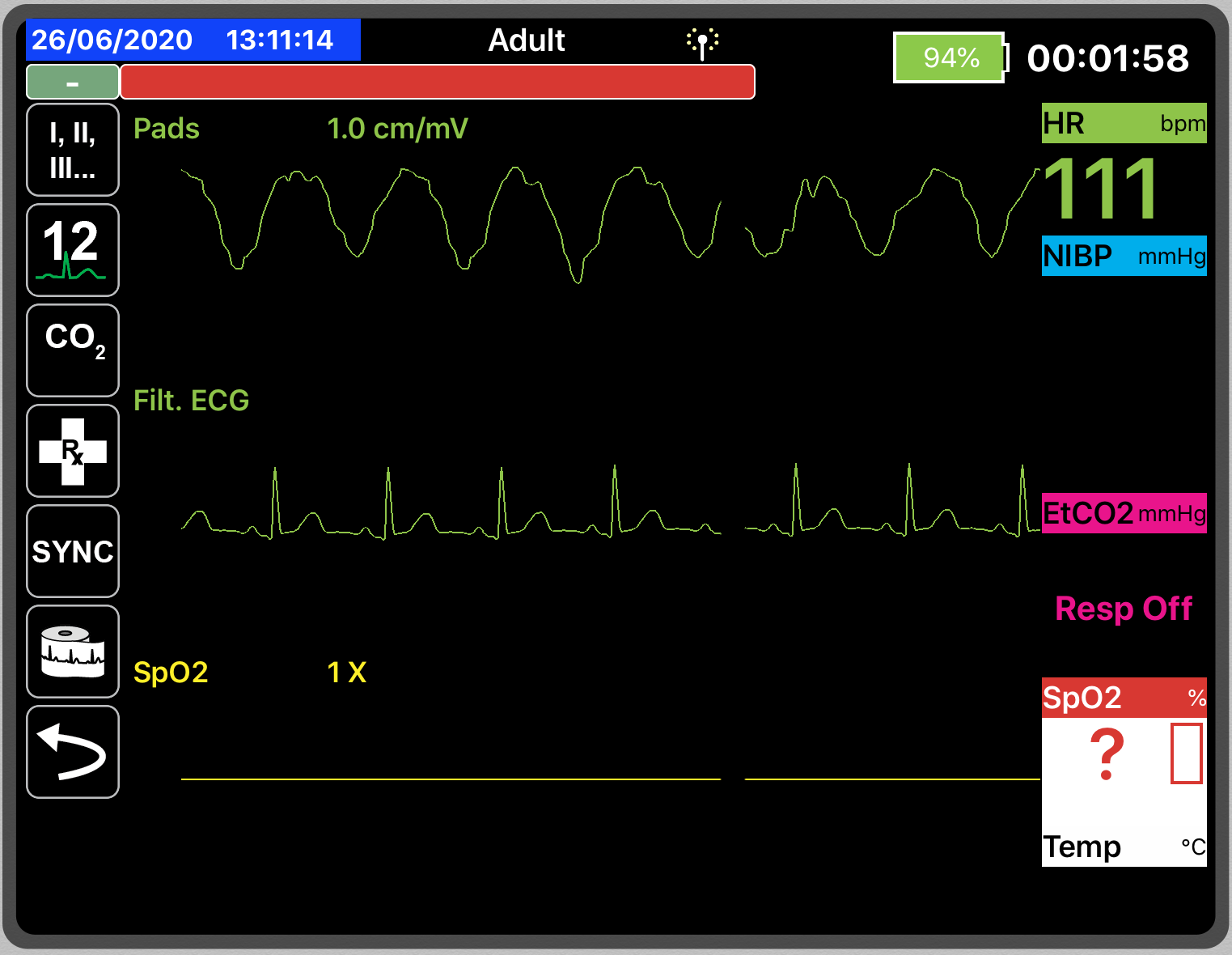 Control - Section 4: CPR, PEA and Pacing – iSimulate Español