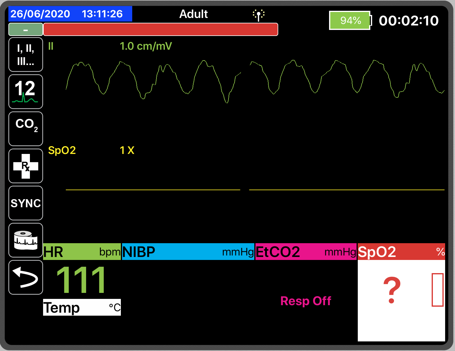 Control - Section 4: CPR, PEA and Pacing – iSimulate 한국어