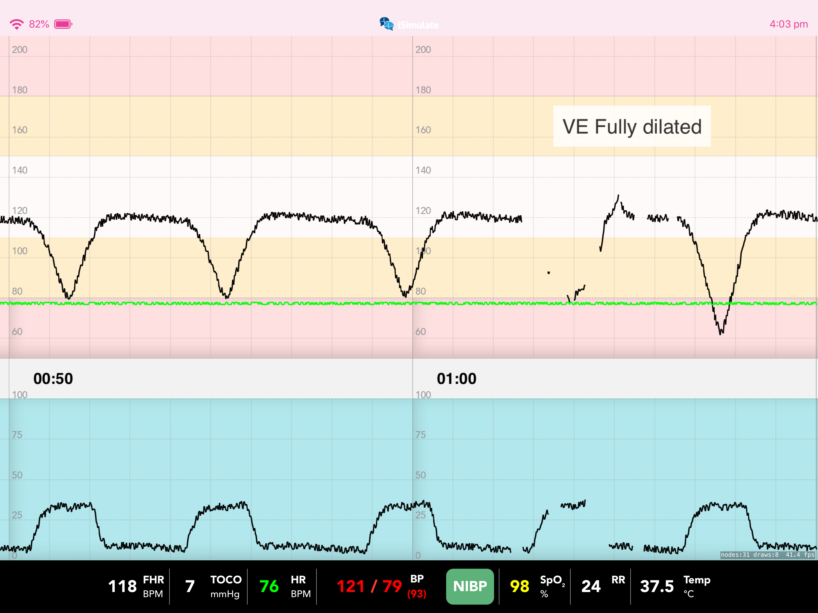 Monitor Mode Overview – iSimulate Español
