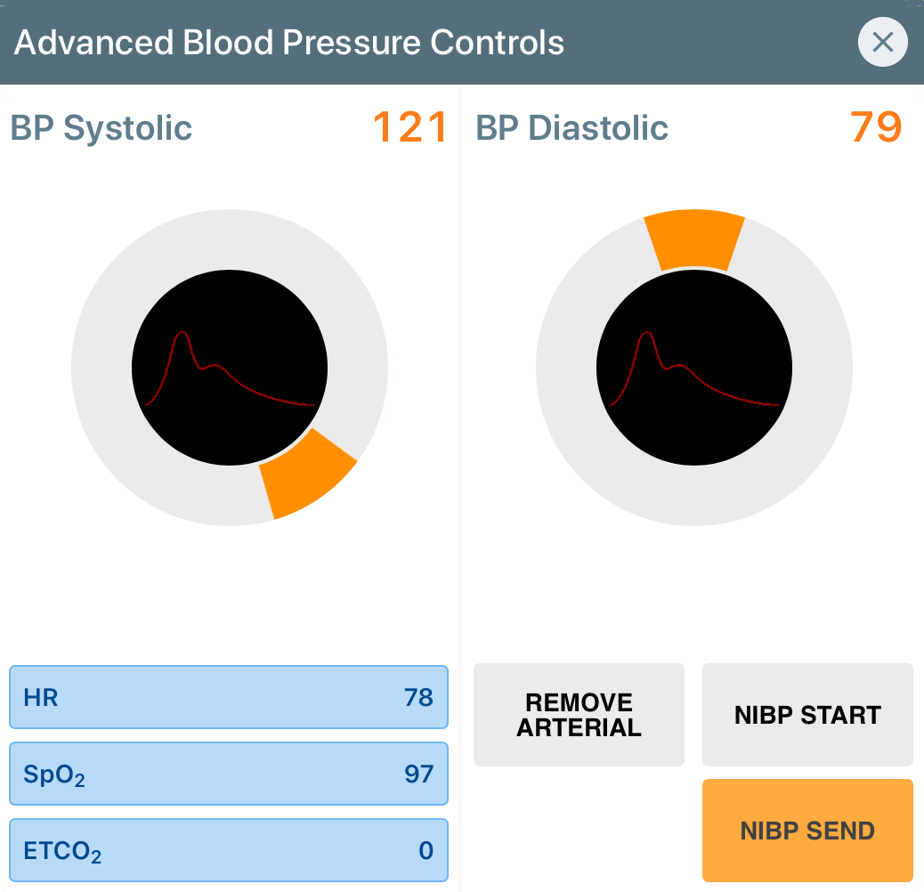 Control - Section 2: Blood Pressure Control – iSimulate 한국어