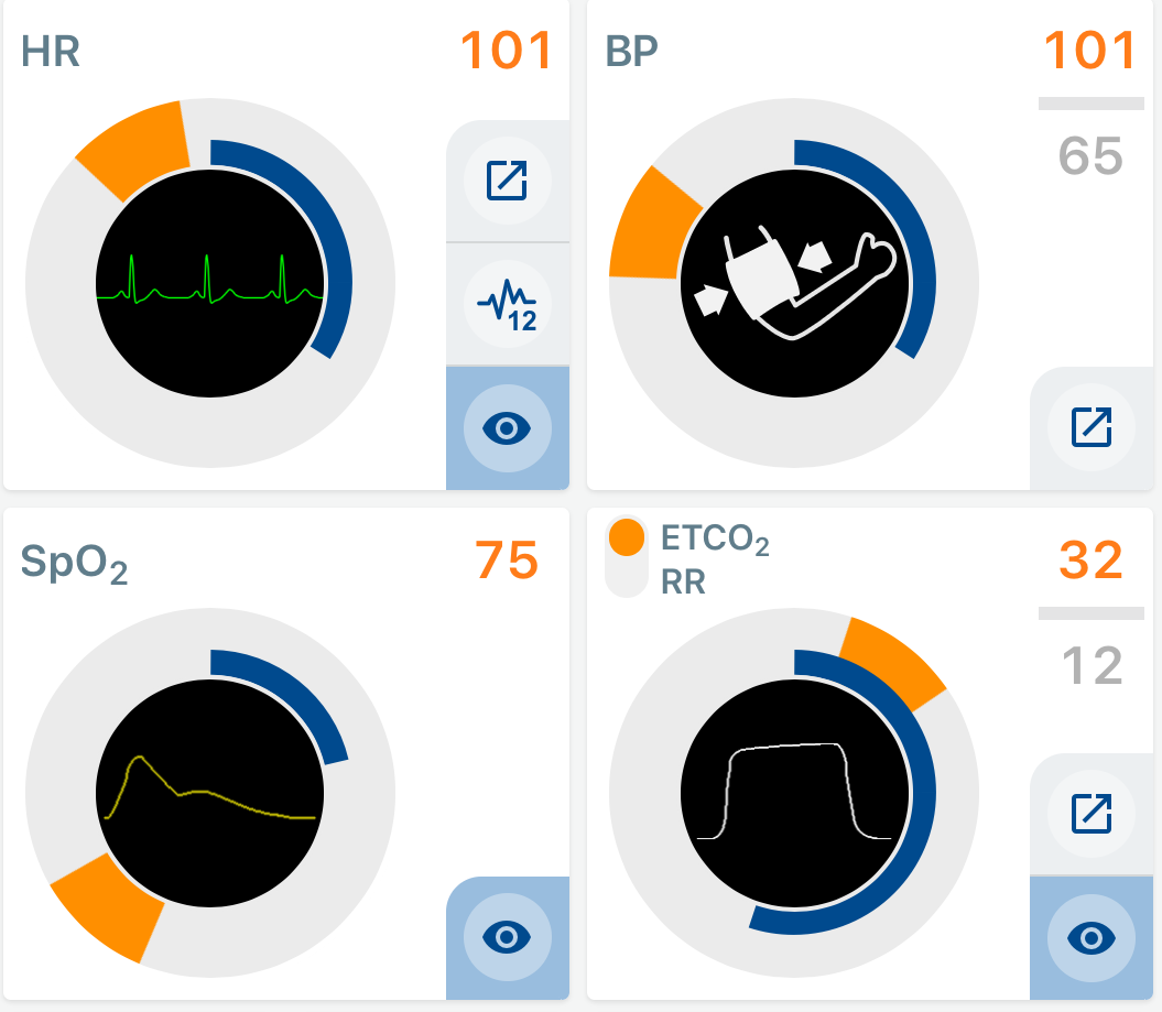 Control - Section 6: Trending – iSimulate