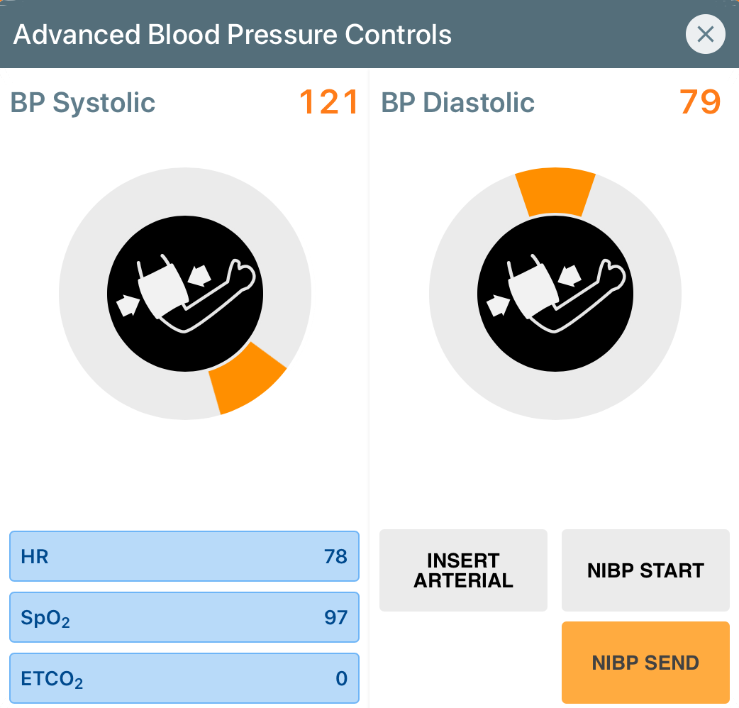 Control - Section 2: Blood Pressure Control – iSimulate