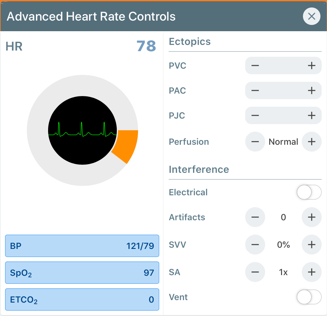 Control - Section 2: Heart Rate and ECG Control – iSimulate