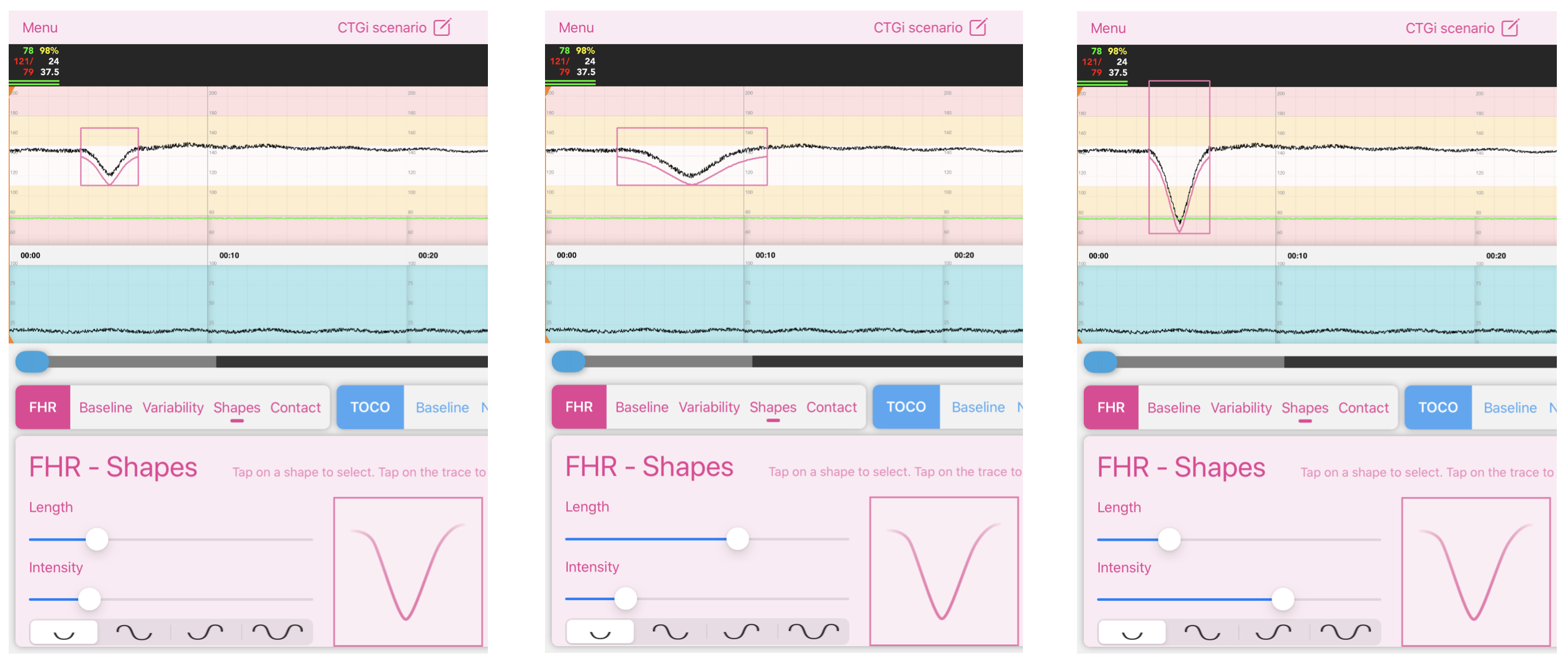 Section 4: Fetal Heart Rate – iSimulate