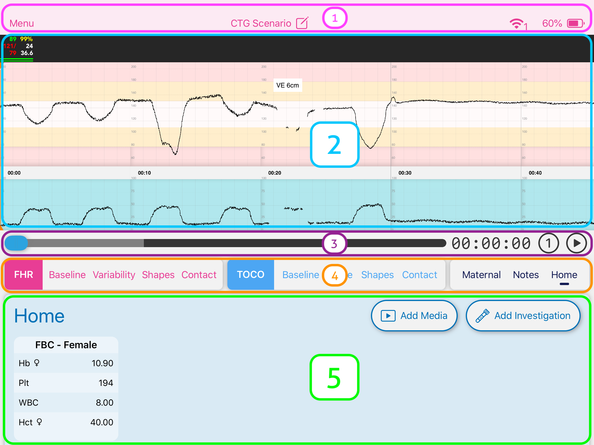 Overview of the CTGi Facilitator Screen – iSimulate