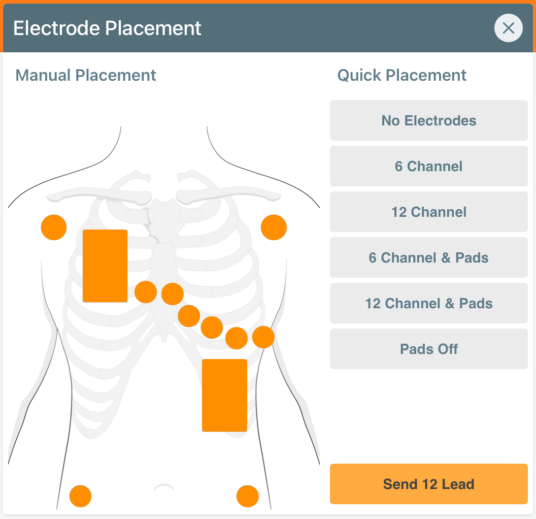 Control - Section 2: Electrode placement and AED screens – iSimulate
