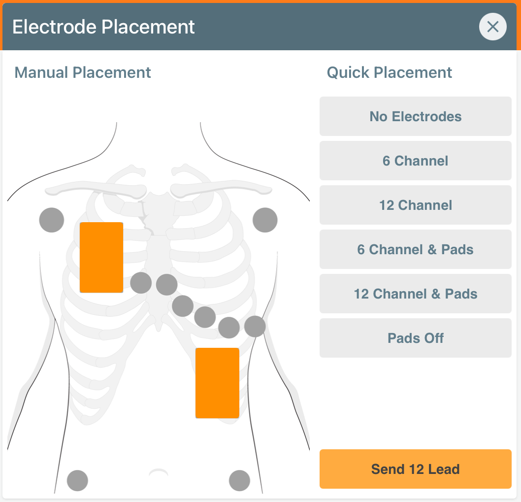 Control - Section 2: Electrode placement and AED screens – iSimulate