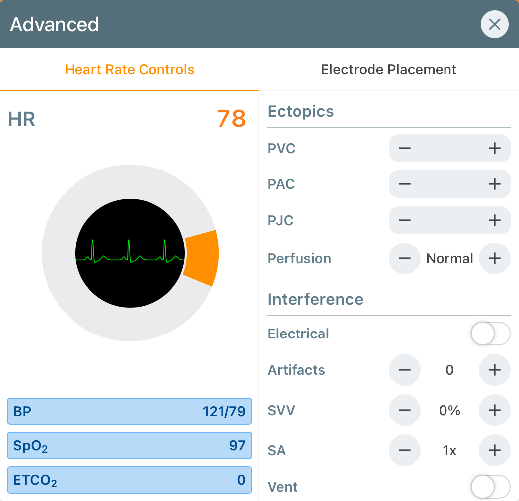 Control - Section 2: Heart Rate and ECG Control – iSimulate