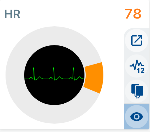 Control - Section 2: Heart Rate and ECG Control – iSimulate
