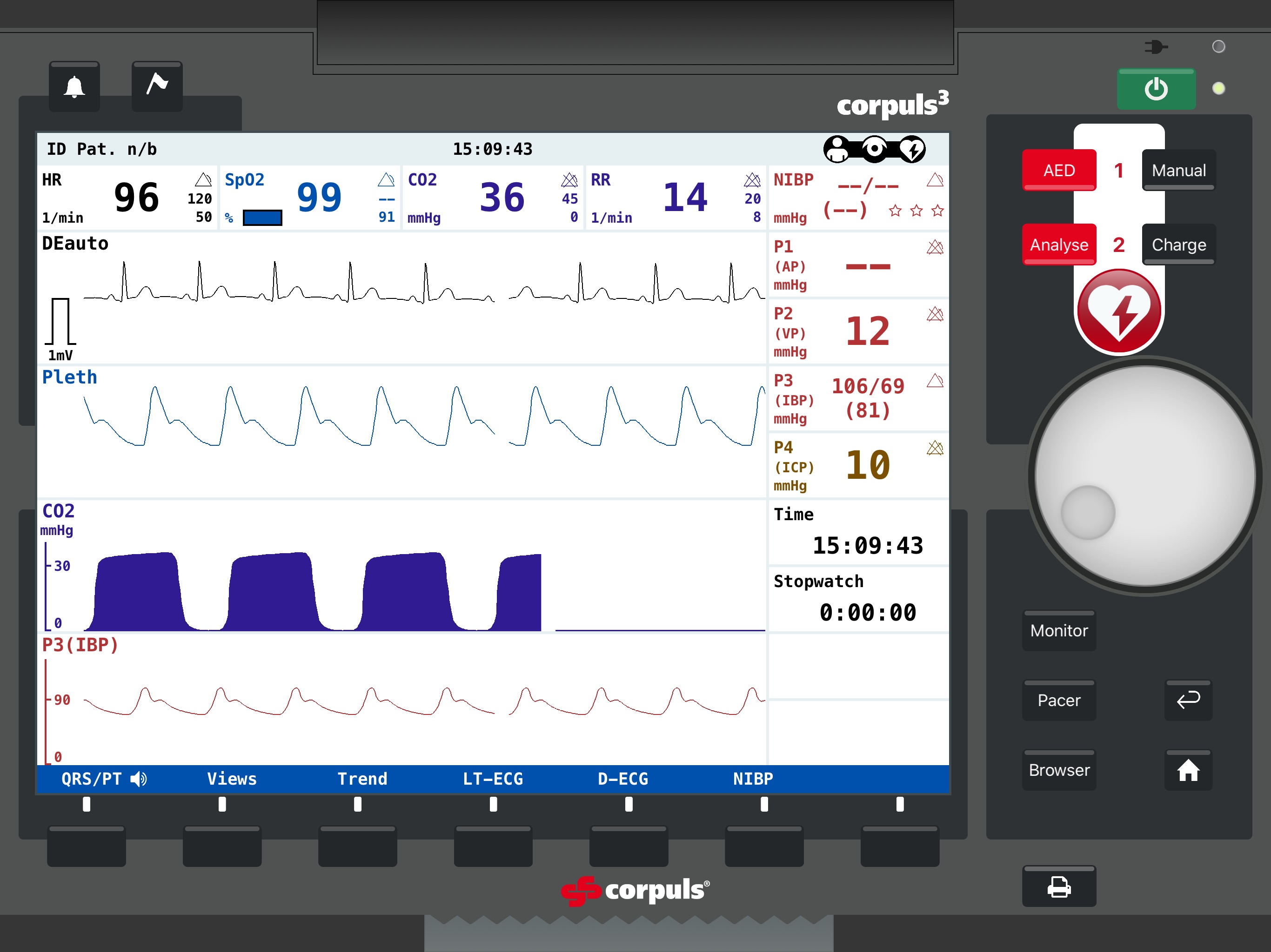 Update Version 10.1 – iSimulate